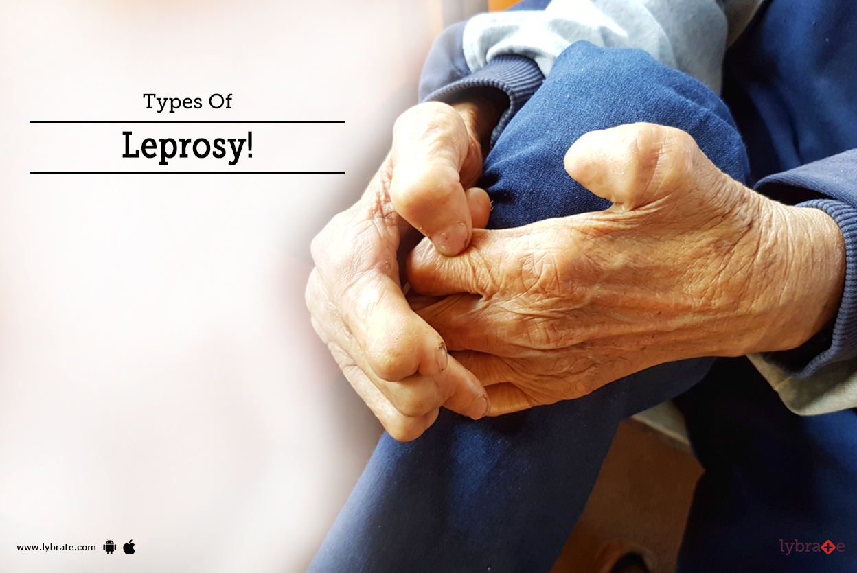 Types Of Leprosy! - By Dr. Sanjeev Kumar Singh | Lybrate