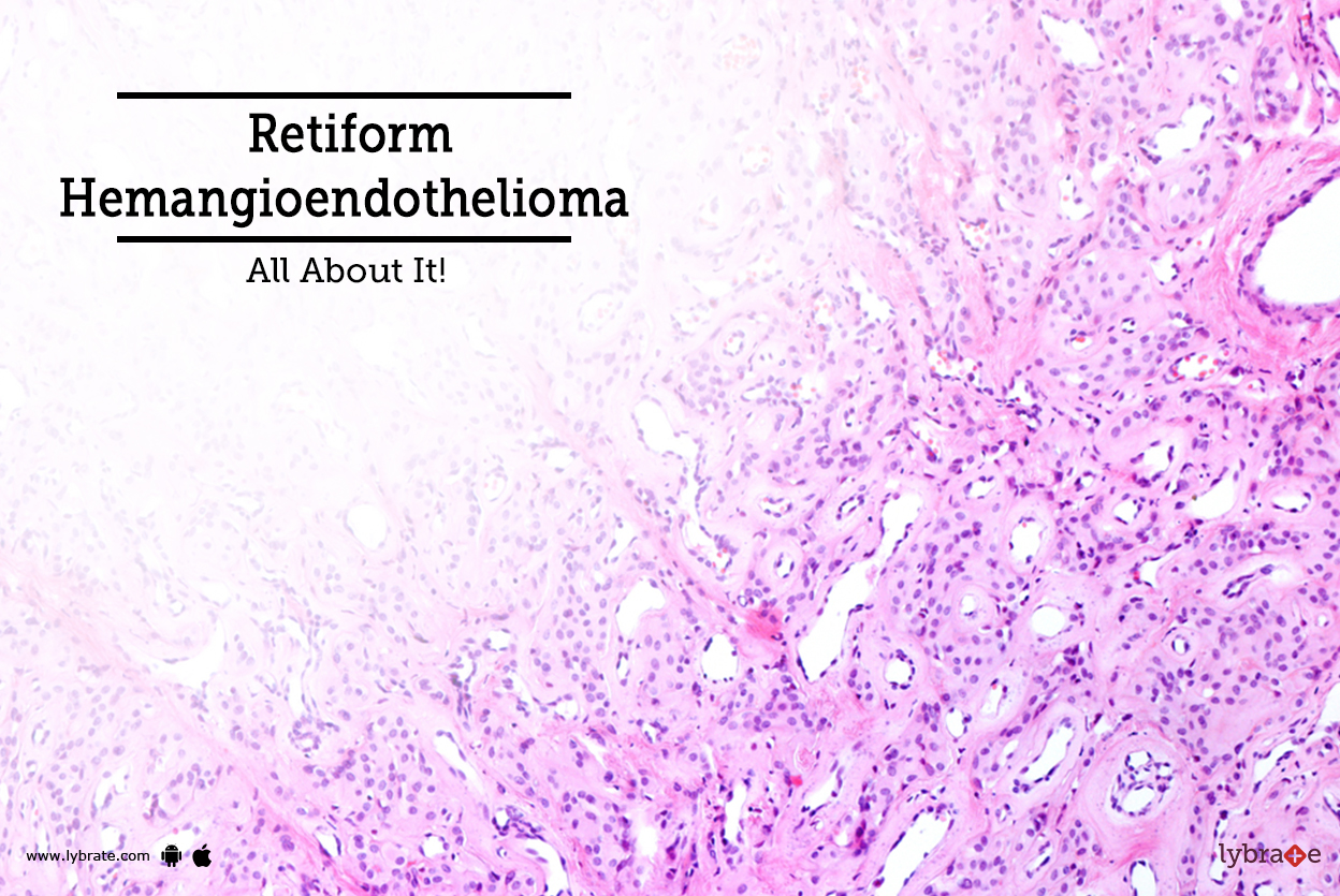 Retiform Hemangioendothelioma - All About It! - By Dr. Amit Patil | Lybrate
