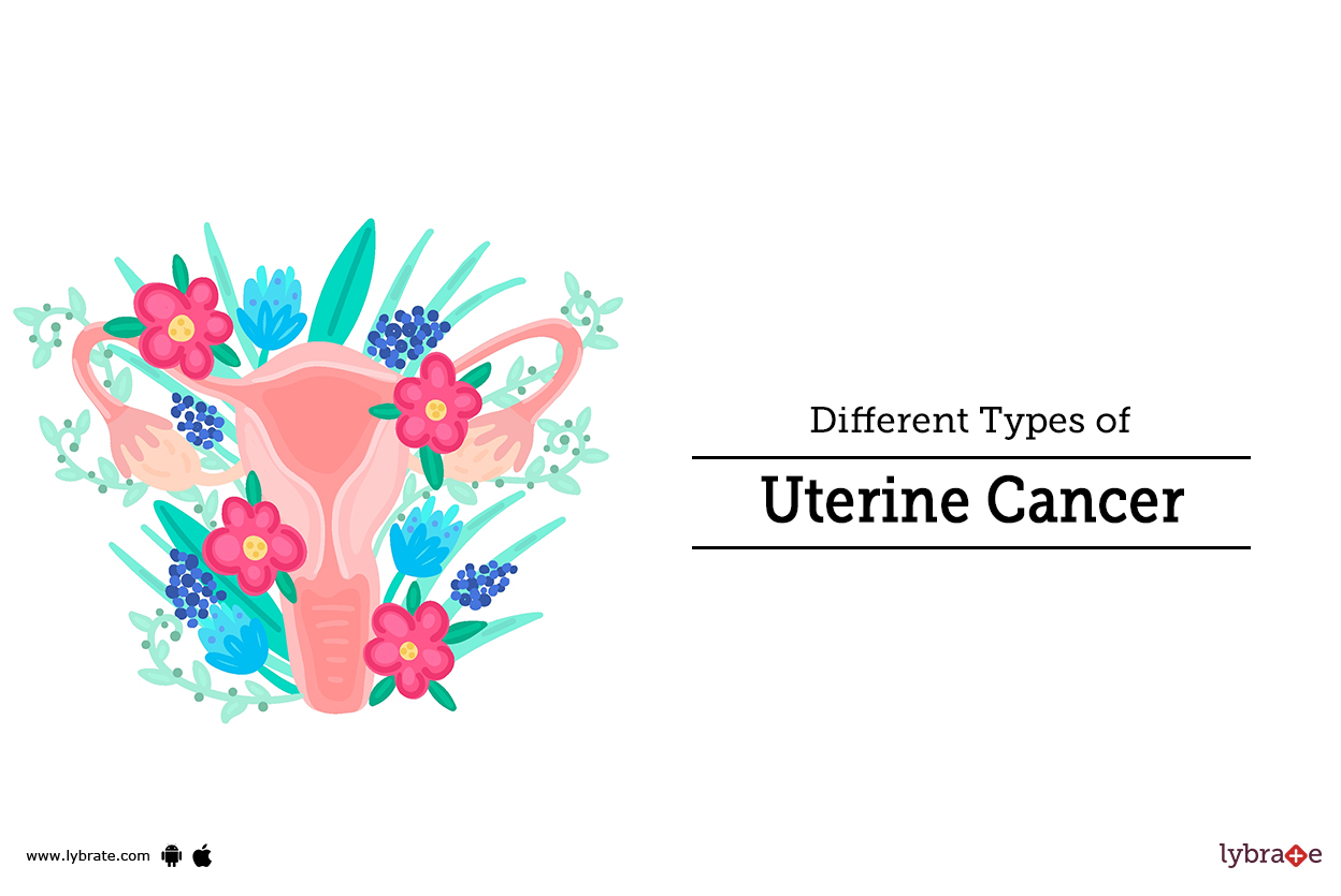 Different Types of Uterine Cancer - By Dr. Garima | Lybrate