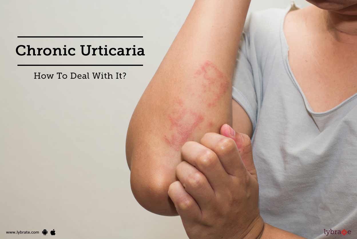 Chronic Urticaria - How To Deal With It? - By Dr. Raghuram Reddy | Lybrate
