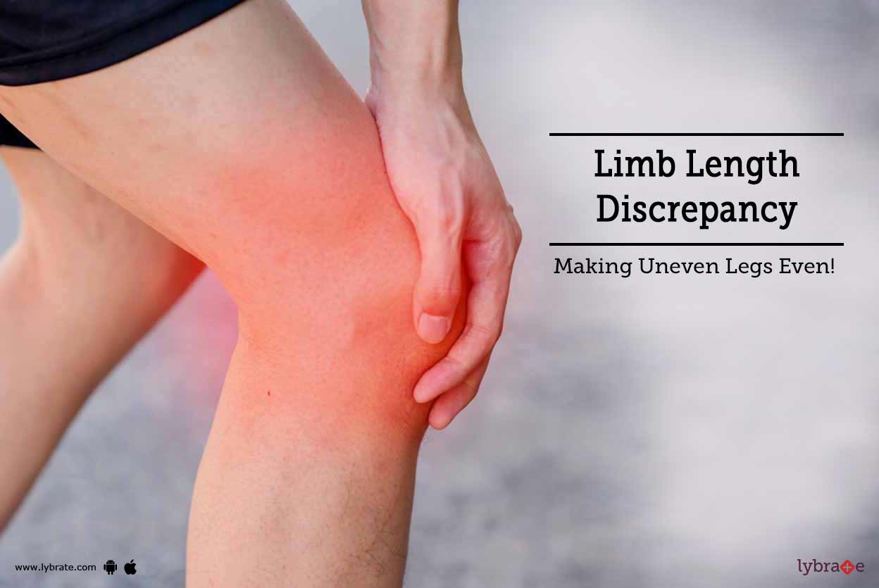 Limb Length Discrepancy - Making Uneven Legs Even! - By Dr. Atul Kumar ...