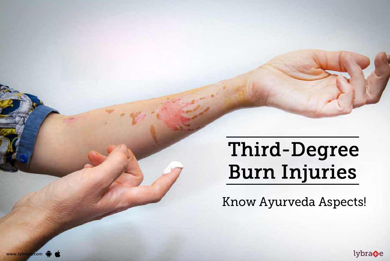 3rd Degree Burn