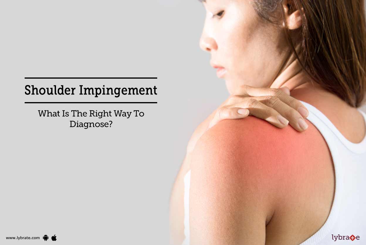 Shoulder Impingement What Is The Right Way To Diagnose By Dr My XXX