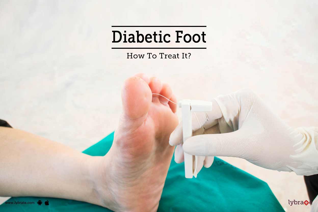 Diabetic Foot - How To Treat It? - By Dr. Yatin Kukreja | Lybrate