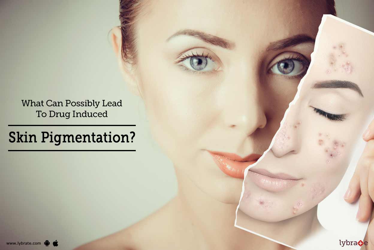 What Can Possibly Lead To Drug Induced Skin Pigmentation? - By Dr ...
