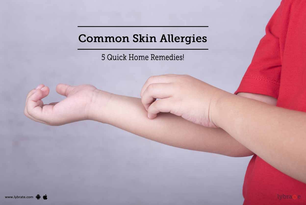 Common Skin Allergies 5 Quick Home Remedies By Dr Arya G R Lybrate