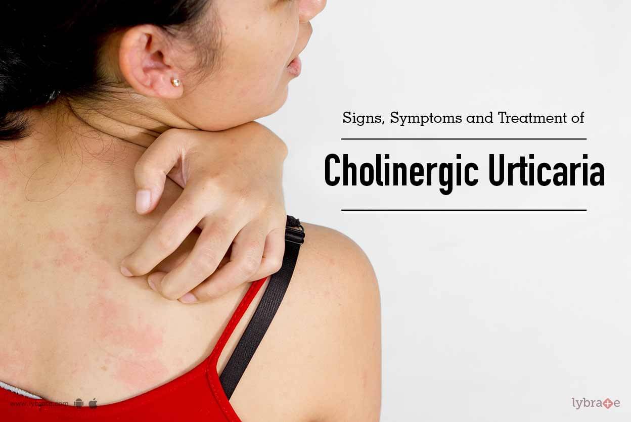 Signs Symptoms And Treatment Of Cholinergic Urticaria By Dr Mukeshd Shah Lybrate