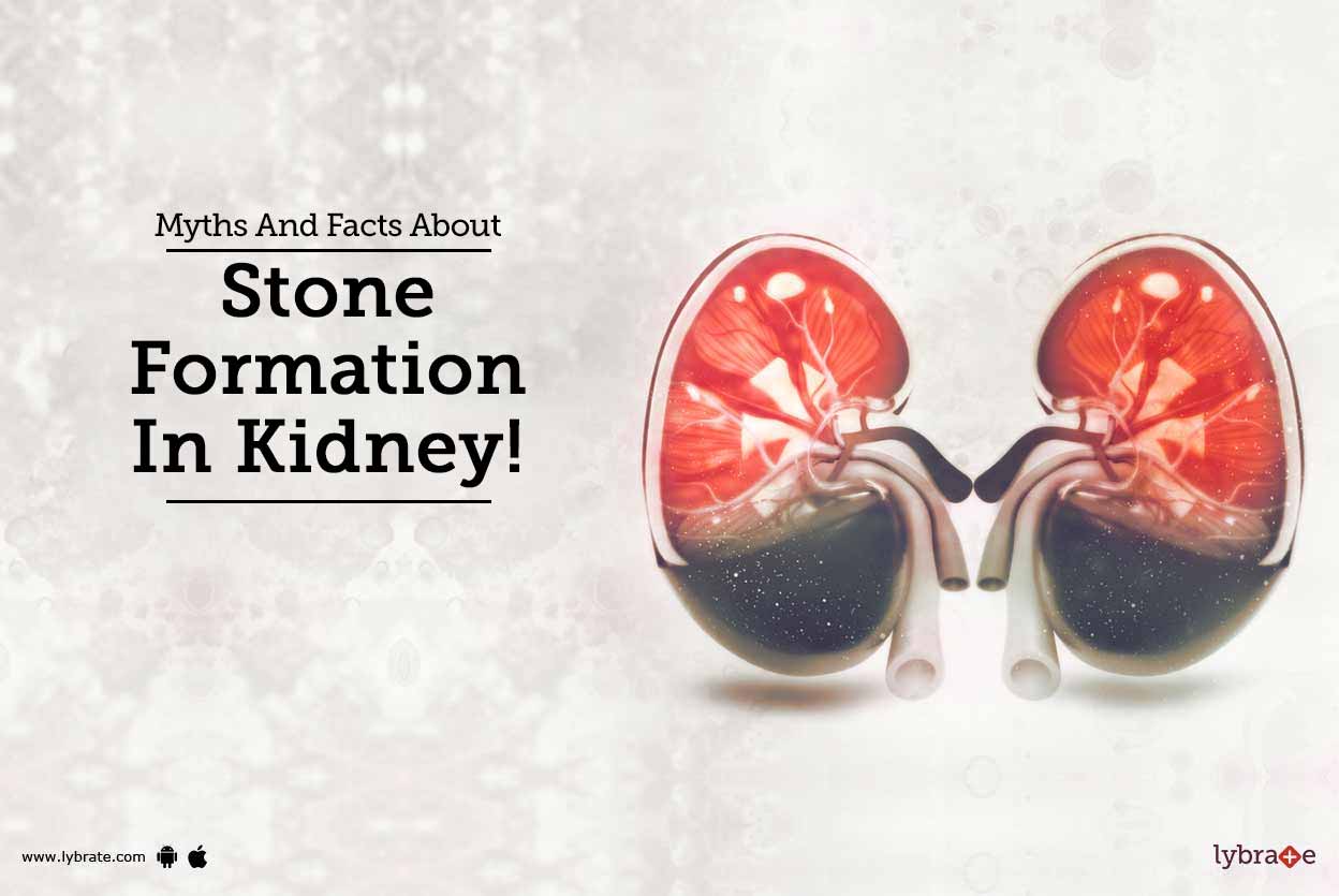 Myths And Facts About Stone Formation In Kidney! - By Dr. Rahul Poddar ...