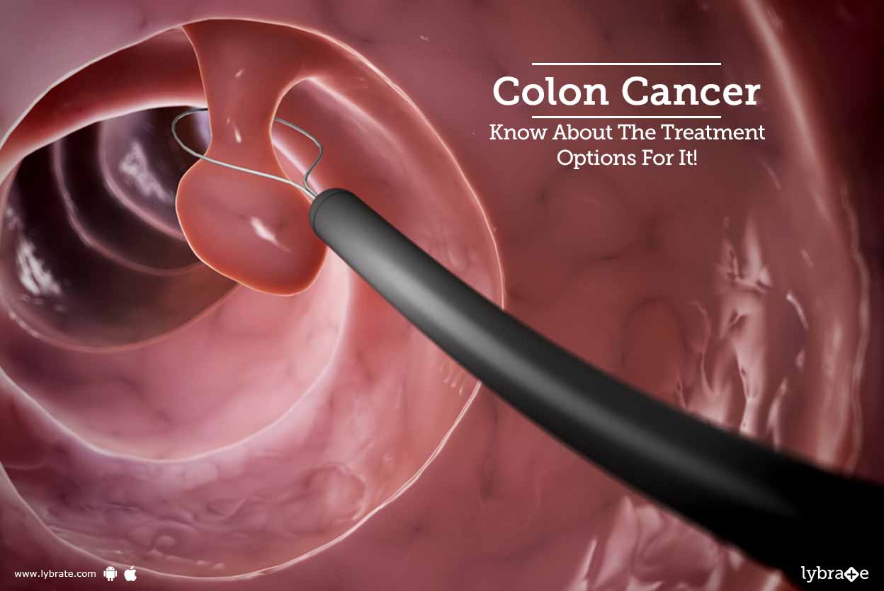 Colon Cancer - Know About The Treatment Options For It! - By Dr. Anil ...