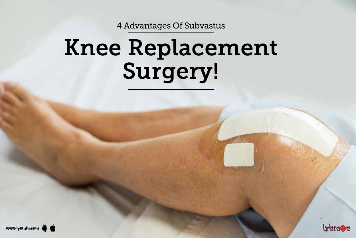4 Advantages Of Subvastus Knee Replacement Surgery! - By Dr. Kunal ...