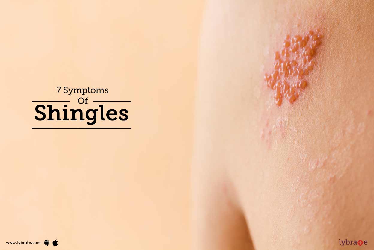 7 Symptoms Of Shingles - By Dr. Ranjan Upadhyay | Lybrate