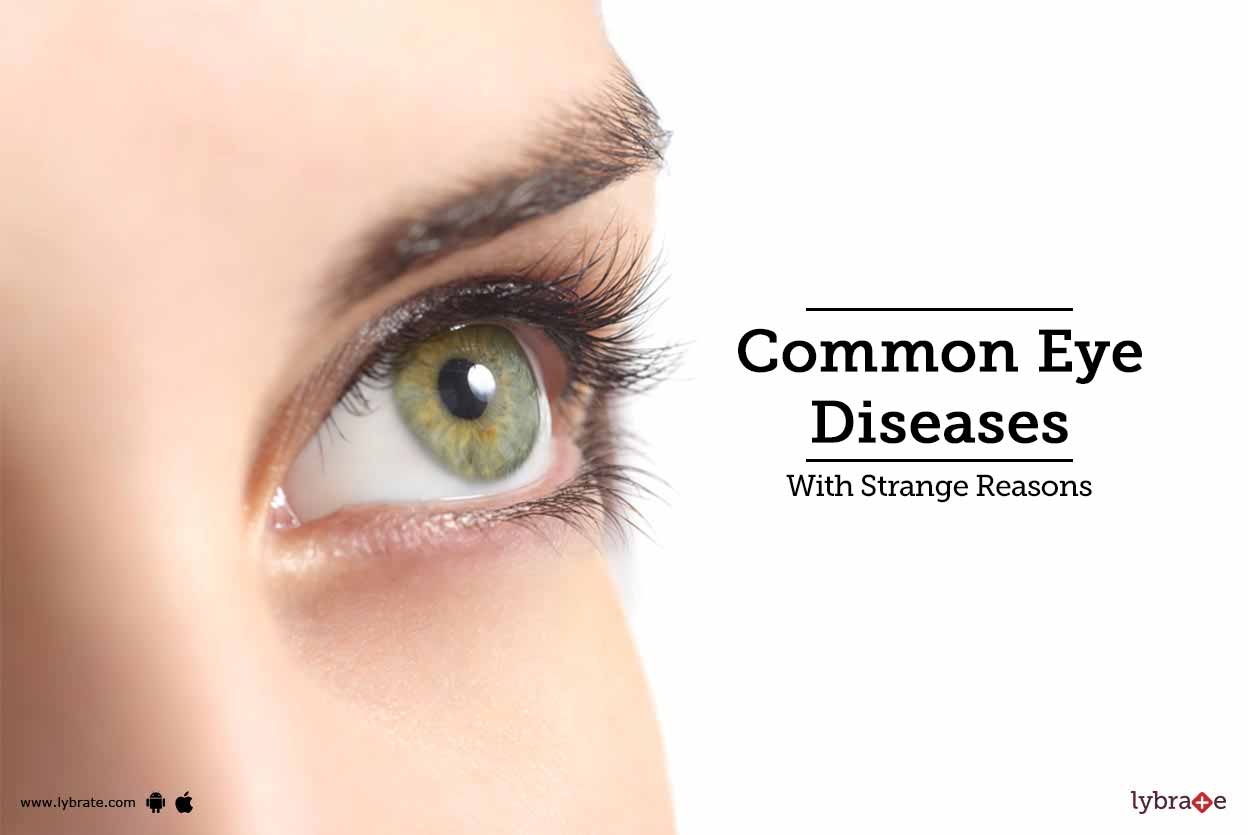 Common Eye Diseases With Strange Reasons - By Dr. Harshavardhan ...