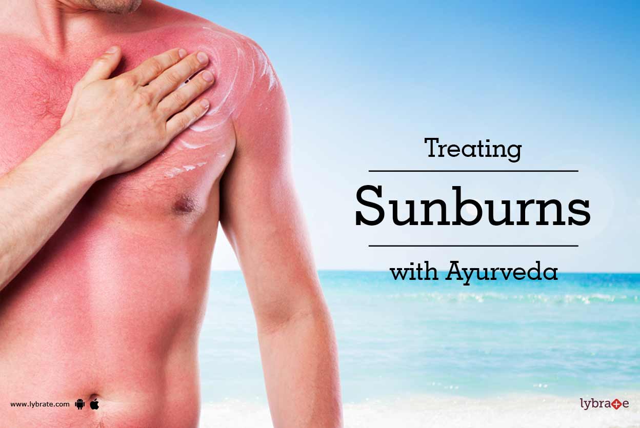 Treating Sunburns with Ayurveda - By Dr. Pratik Bhoite | Lybrate