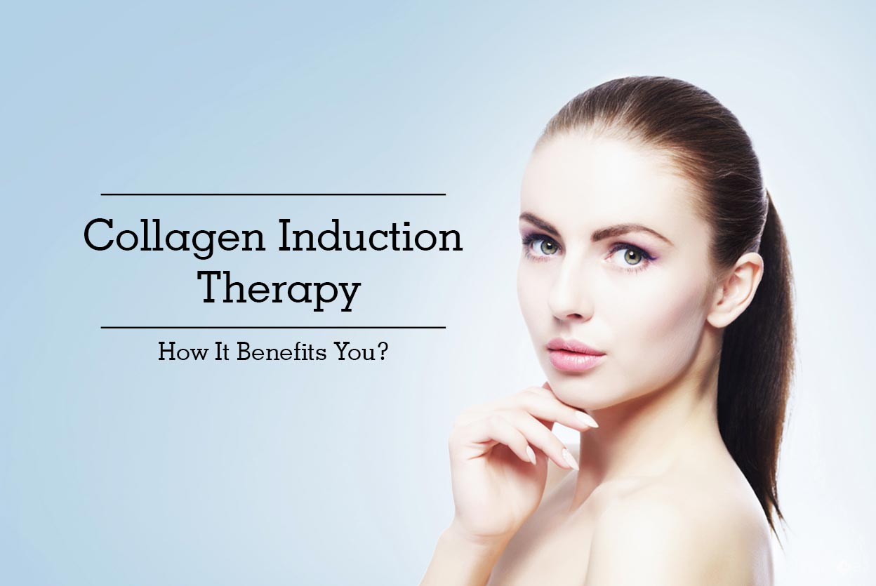 Collagen Induction Therapy - How It Benefits You? - By Looks Forever ...