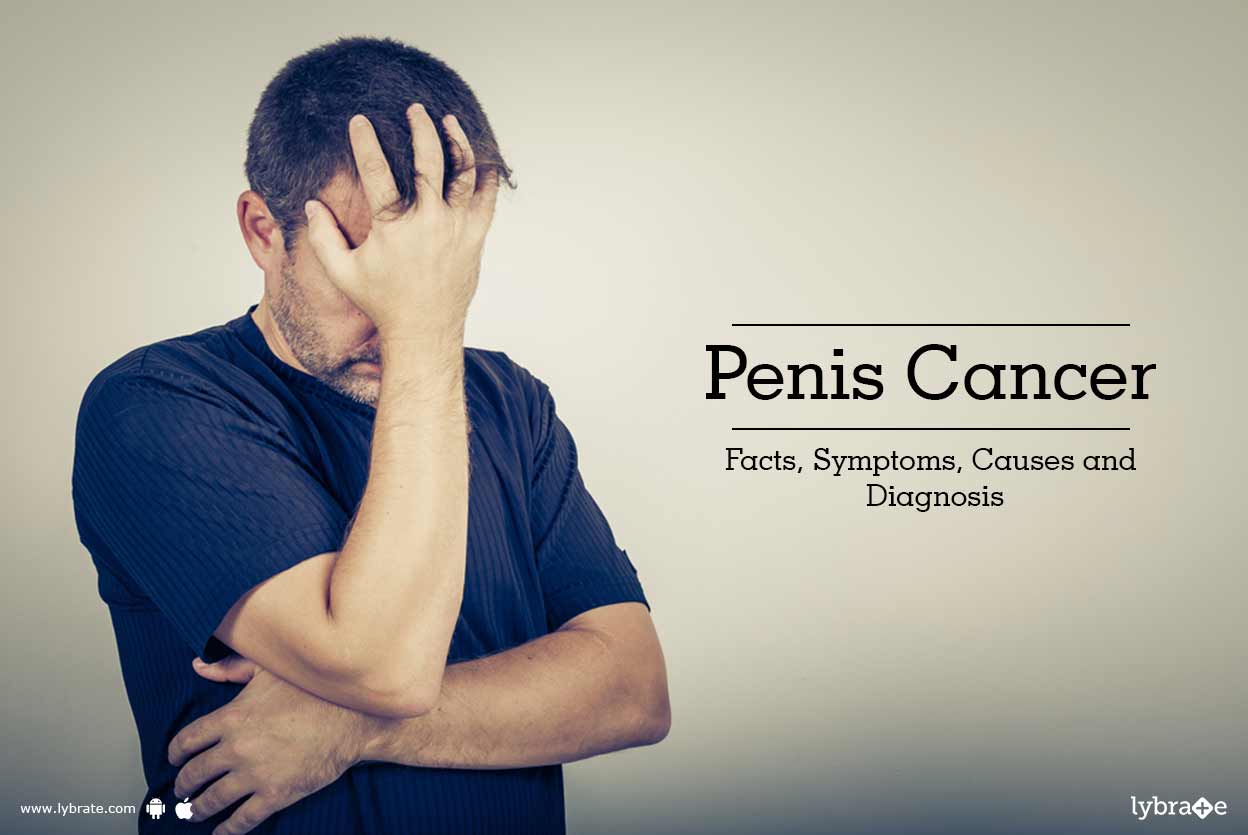 Penis Cancer: Facts, Symptoms, Causes and Diagnosis - By Dr. M.S ...