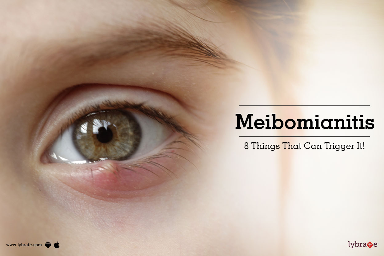 Meibomianitis - 8 Things That Can Trigger It! - By Wavikar Eye ...