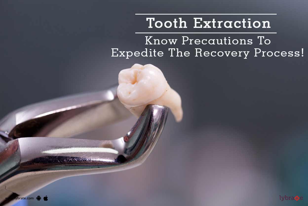 Tooth Extraction - Know Precautions To Expedite The Recovery Process ...
