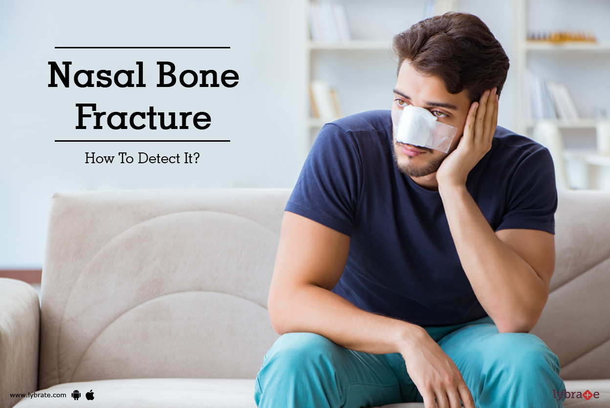 Nasal Bone Fracture - How To Detect It? - By Dr. Palak Shroff Bhatti ...