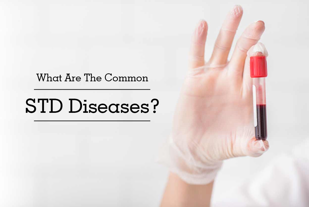What Are The Common STD Diseases? - By Dr. Masroor Ahmad Wani | Lybrate