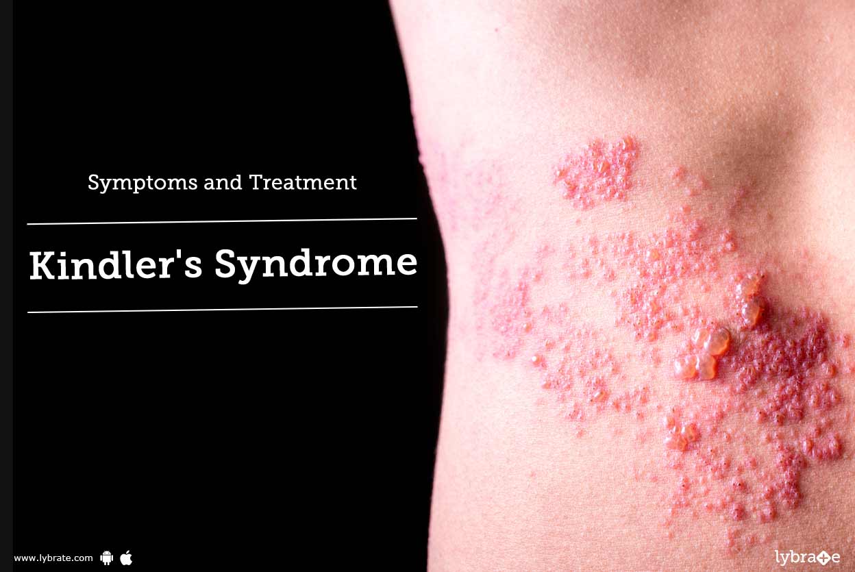 Symptoms and Treatment: Kindler's Syndrome - By Dr. Rasya Dixit | Lybrate