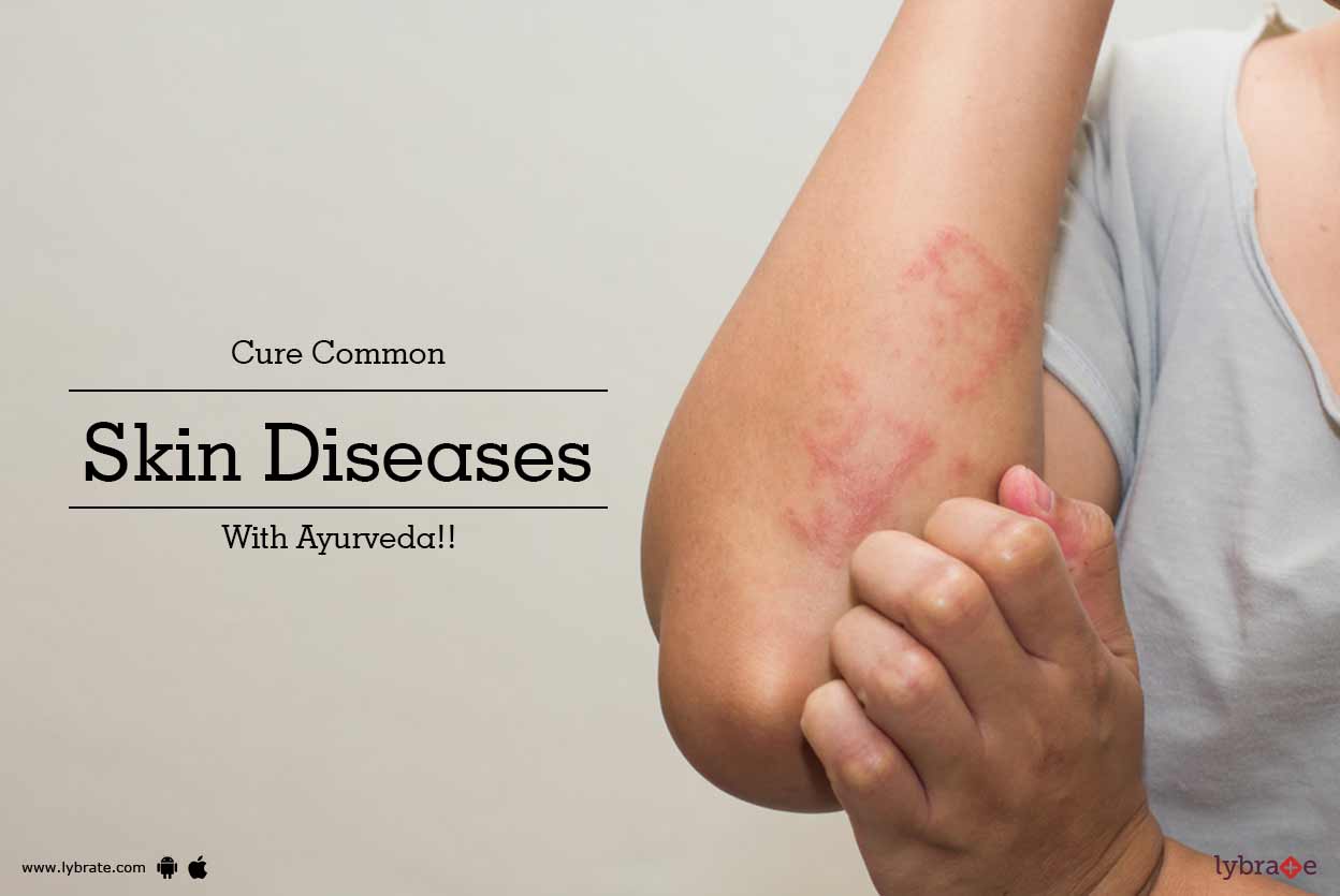 Cure Common Skin Diseases With Ayurveda!! - By Dr. K D | Lybrate