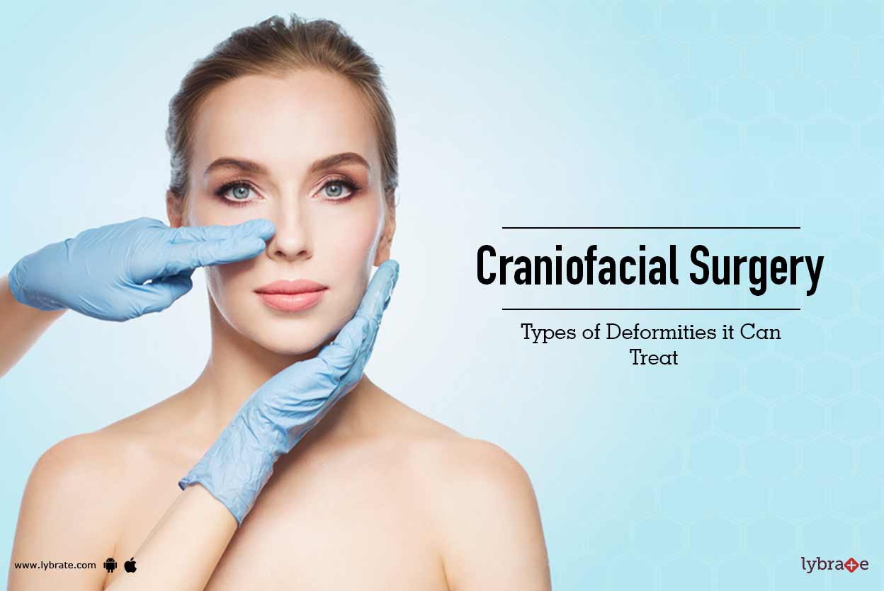 Craniofacial Surgery - Types of Deformities it Can Treat - By Dr. Yv ...