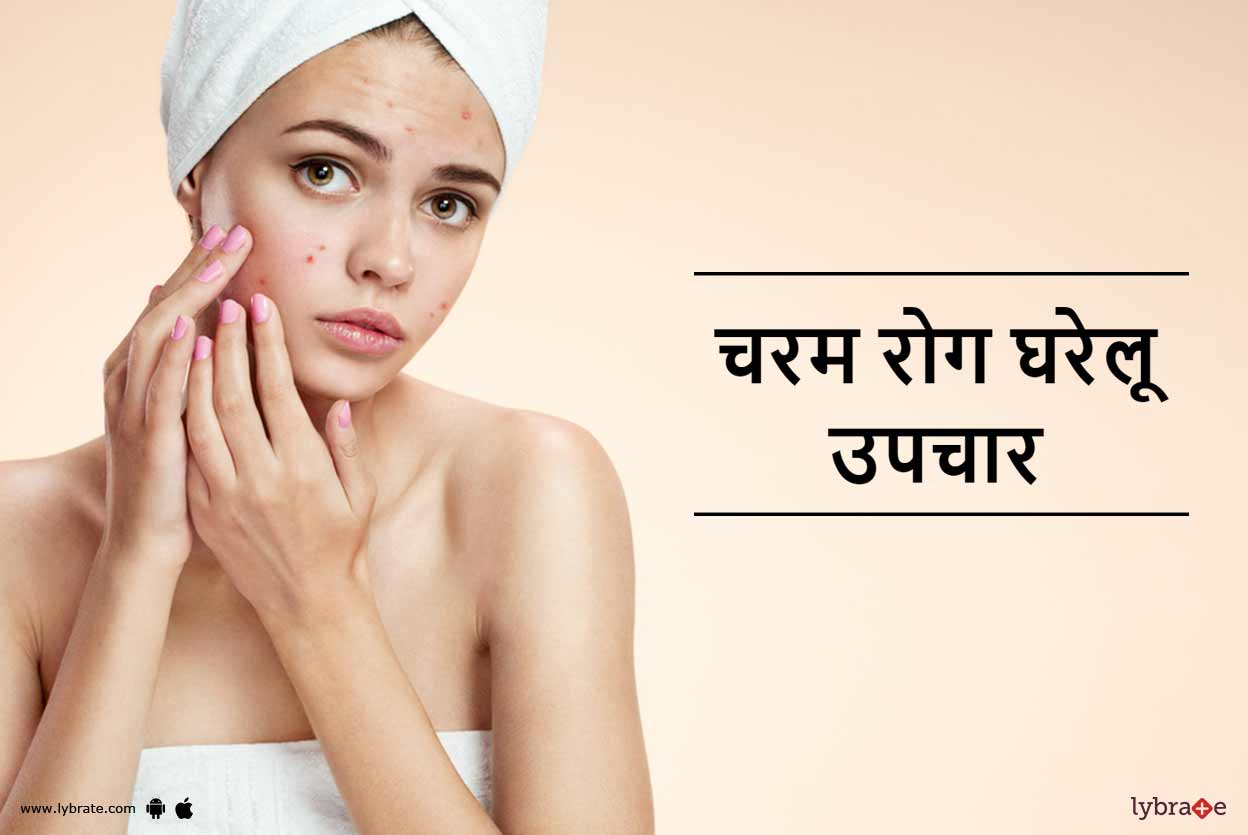 चरम रोग घरेलू उपचार - Charam Rog Ke Liye Ghareloo Upachaar! - By Dr ...