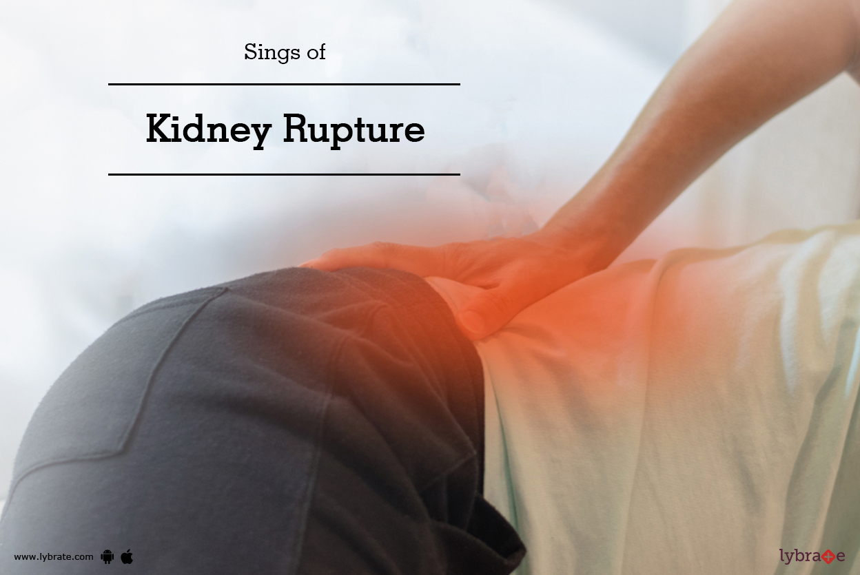 Signs of Kidney Rupture - By Dr. Garima | Lybrate