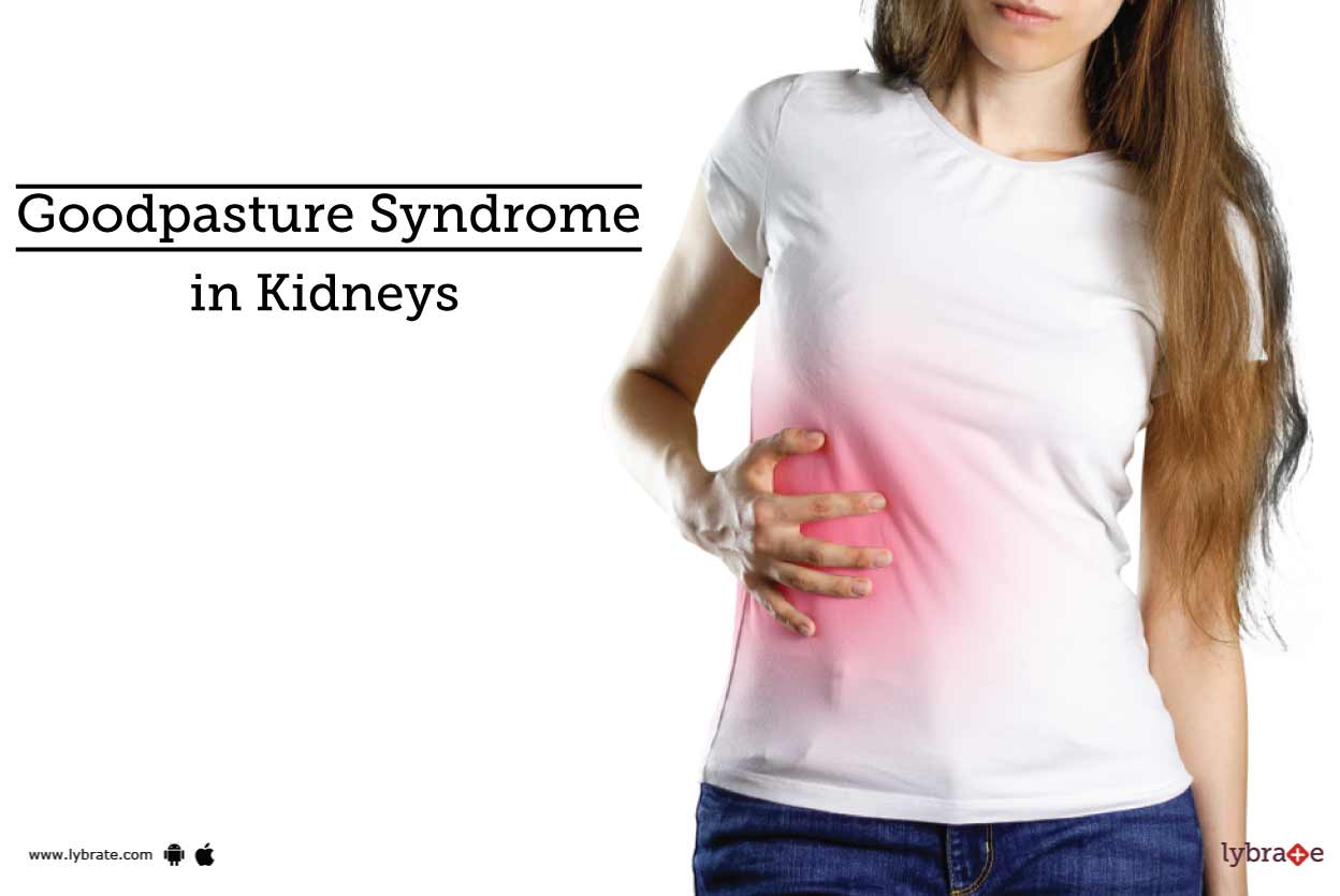 Goodpasture Syndrome in Kidneys - By Dr. Garima | Lybrate
