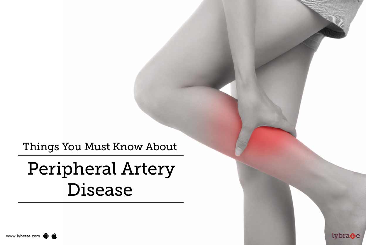 Things You Must Know About Peripheral Artery Disease - By Dr. Garima ...