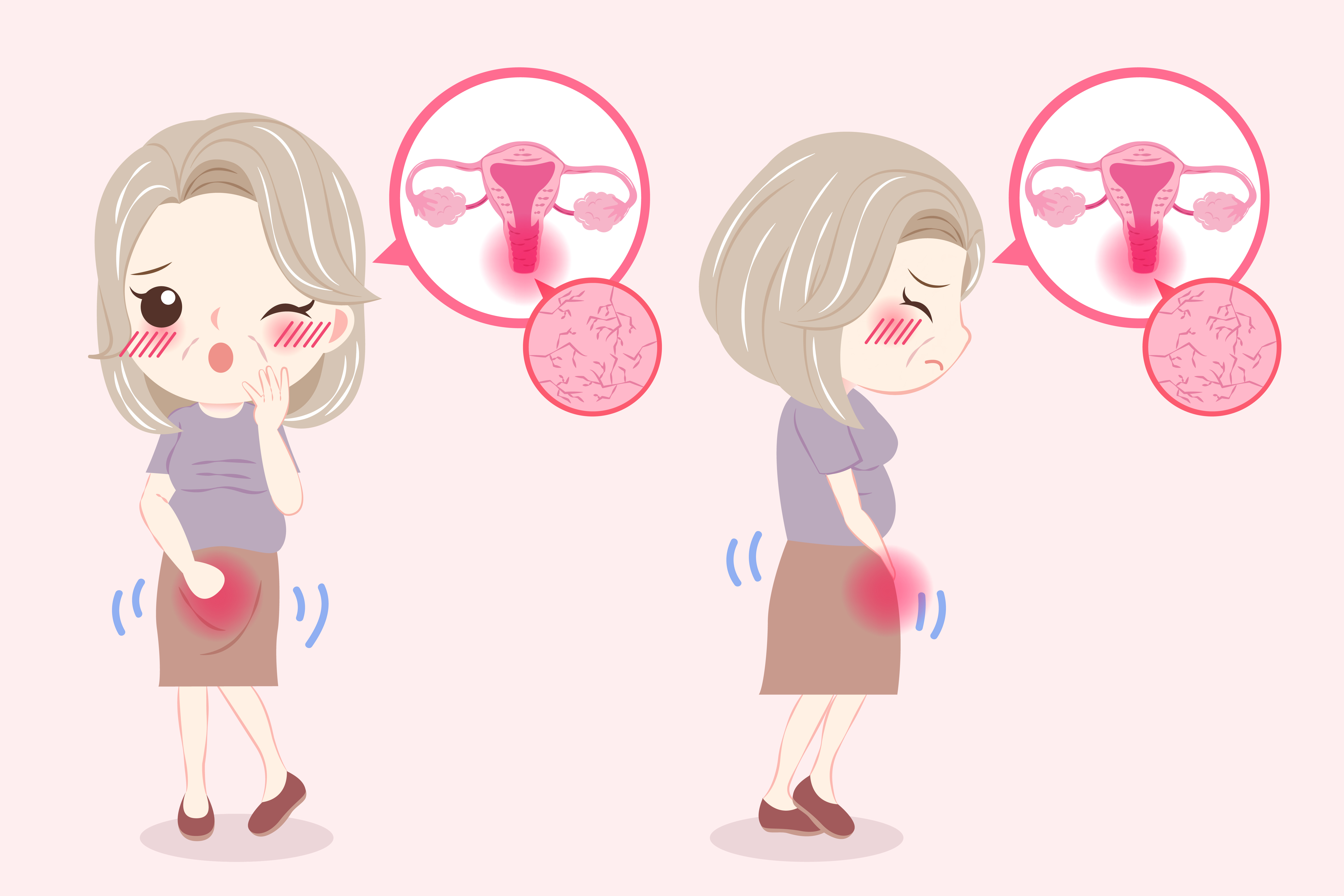 Vaginitis: Treatment, Procedure, Cost, Recovery, Side Effects And More