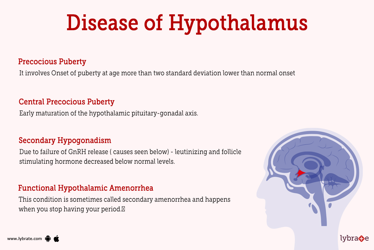 Hypothalamus (Human Anatomy): Picture, Functions, Diseases, and Treatments