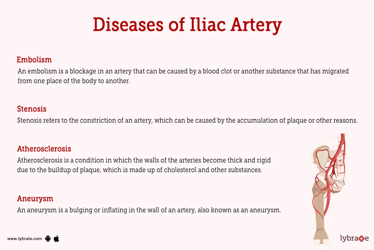 Iliac Artery (Human Anatomy): Image, Functions, Diseases and Treatments