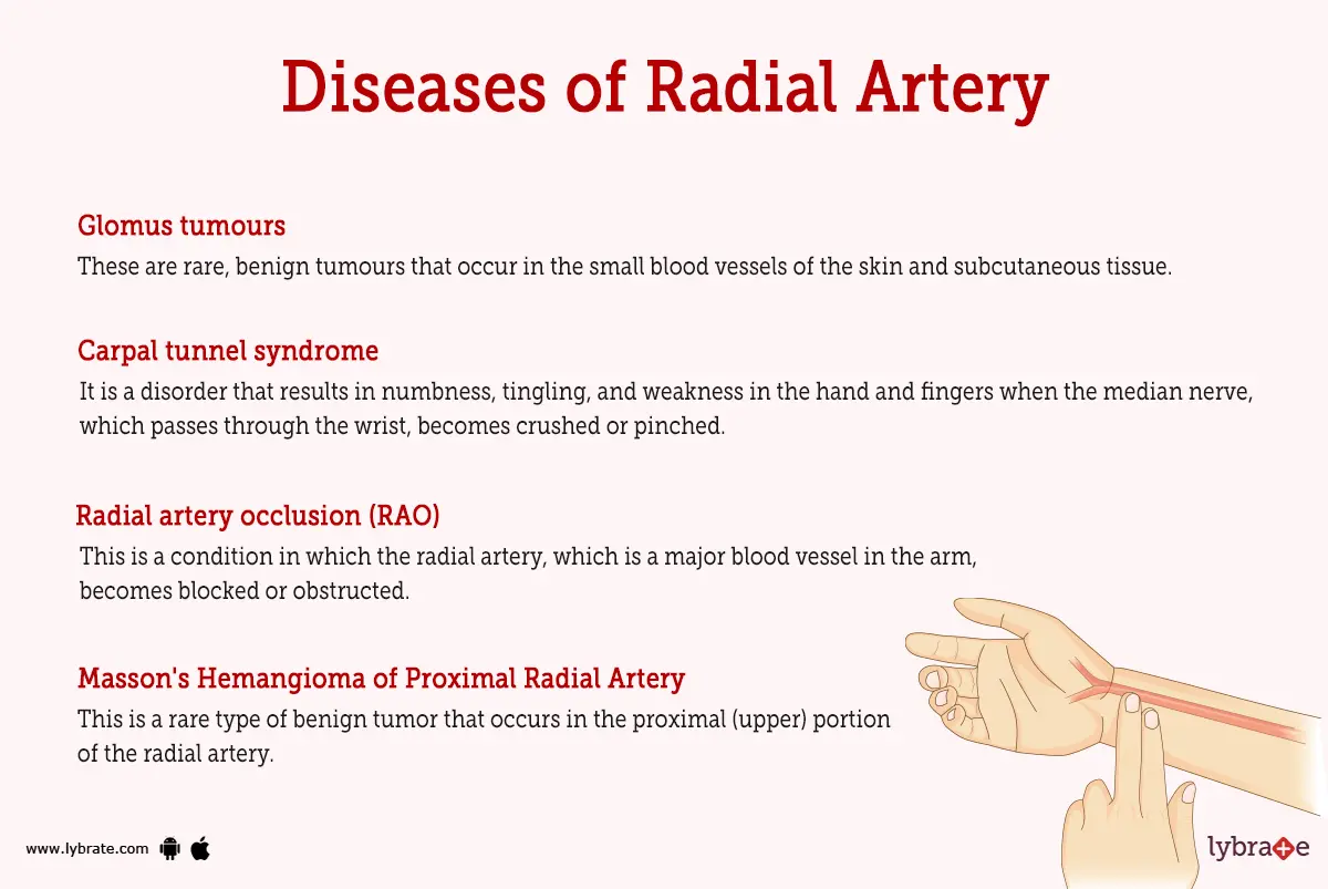 Radial Artery (Human Anatomy): Image, Functions, Diseases and Treatments