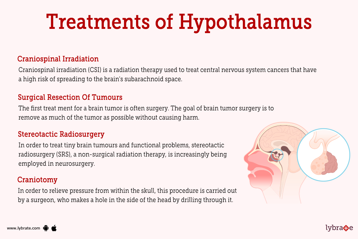 Hypothalamus (Human Anatomy): Picture, Functions, Diseases, and Treatments