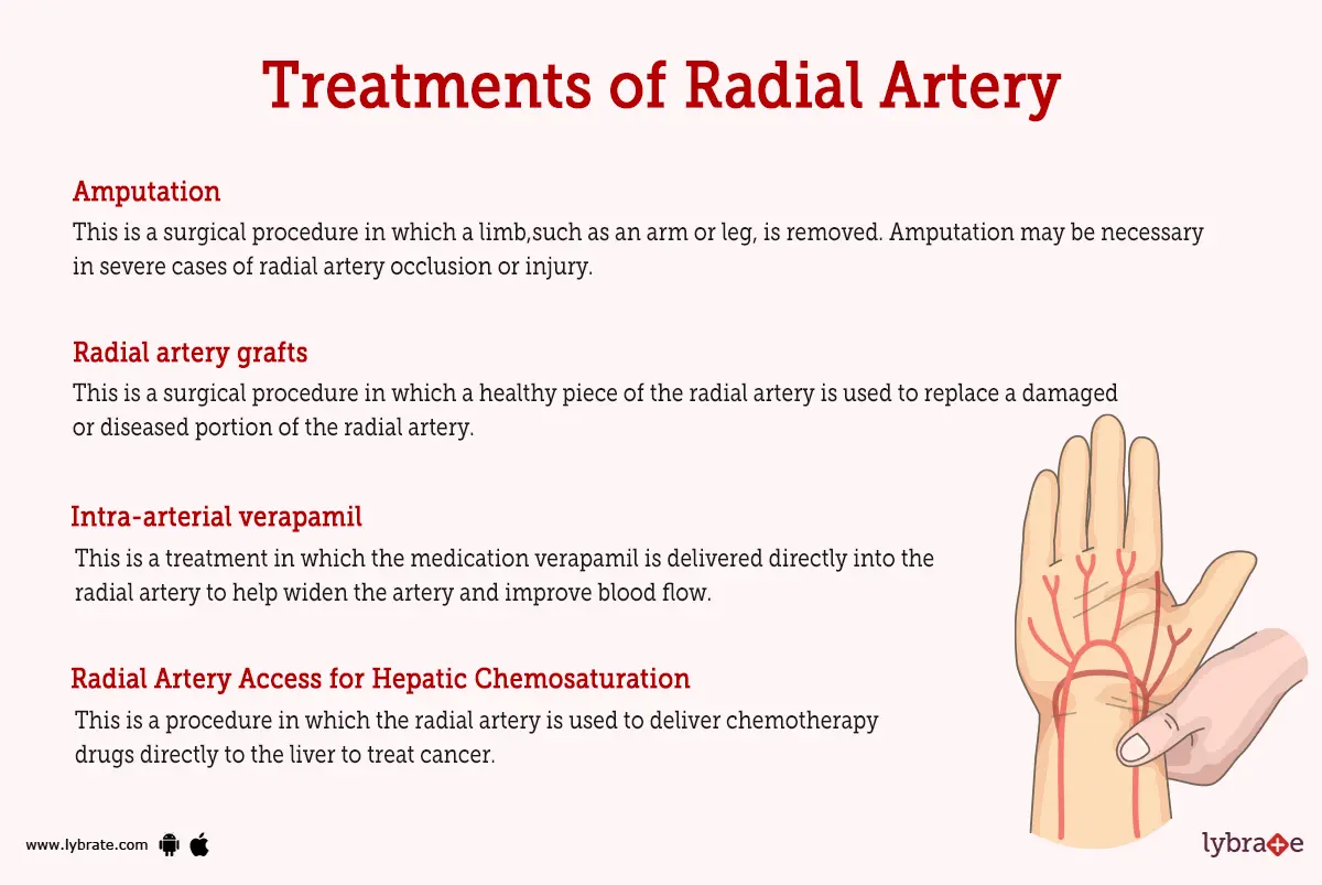 Radial Artery (Human Anatomy): Image, Functions, Diseases and Treatments