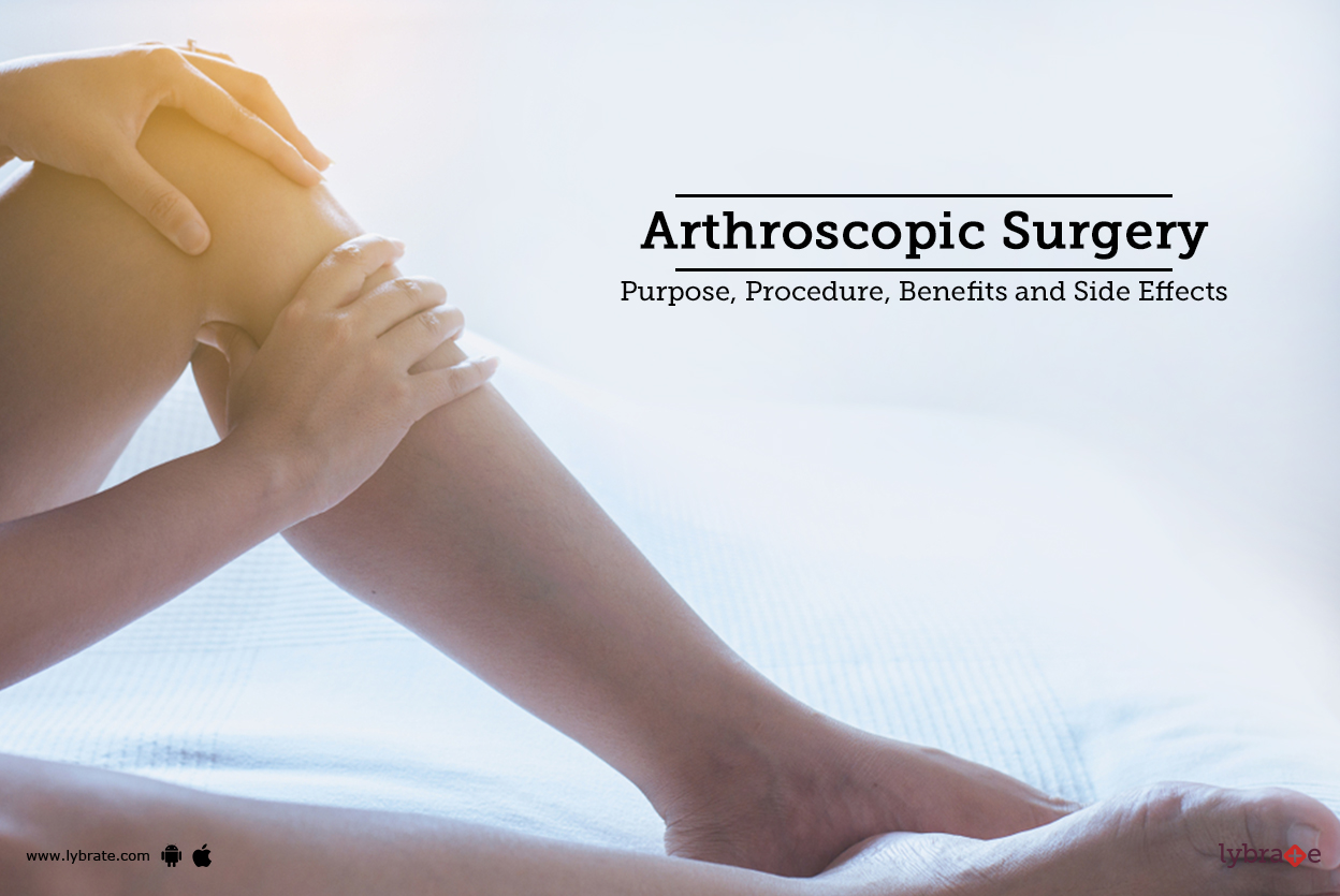 Arthroscopic Surgery: Purpose, Procedure, Benefits and Side Effects