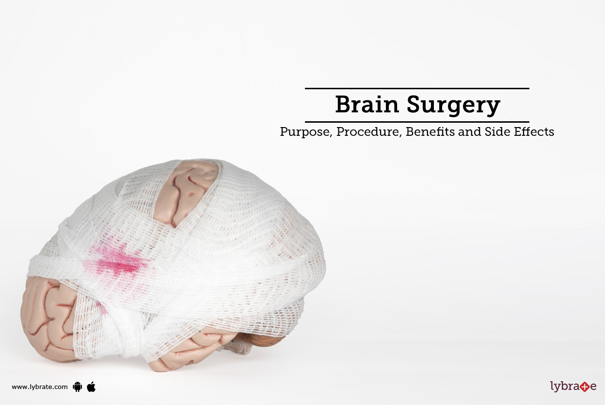 Brain Surgery: Purpose, Procedure, and Benefits and Side Effects