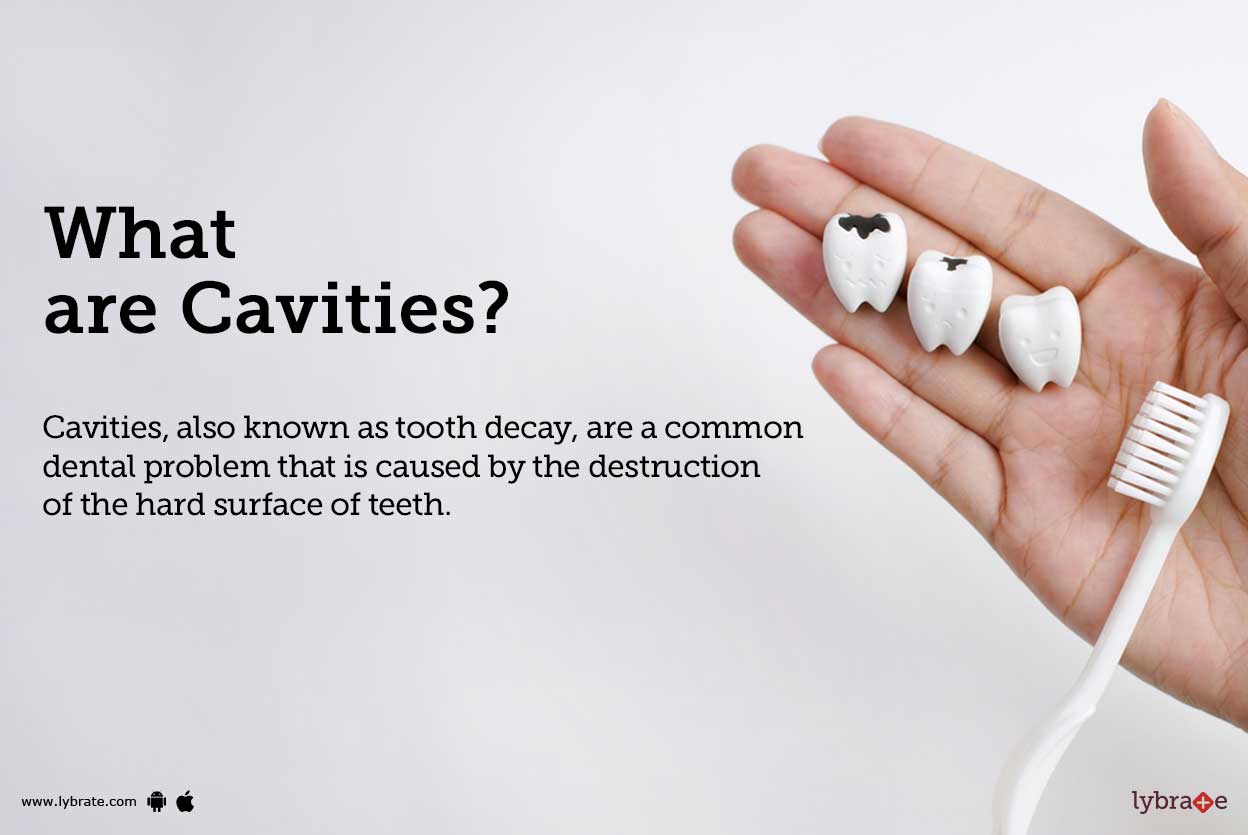 Cavities: Causes, Symptoms, Treatment and Cost