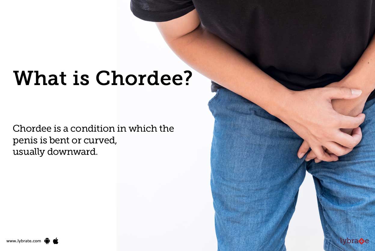 Chordee: Causes, Symptoms, Treatment and Cost