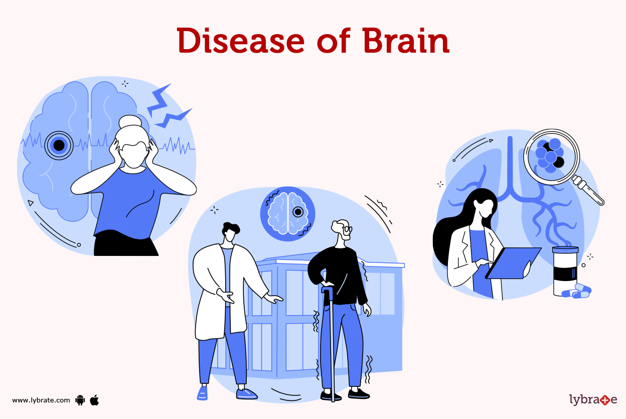 Brain (Human Anatomy): Picture, Function, Parts, Conditions, and More