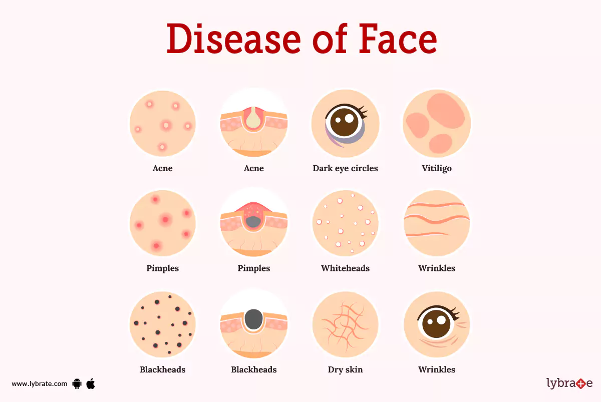 Face (Human Anatomy): Image, Function, Diseases, and Treatments