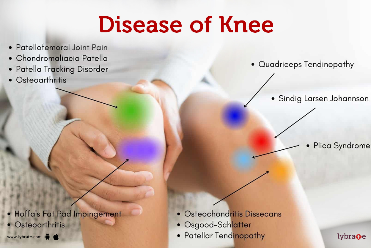 Knee (Human Anatomy): Function, Parts, Diseases, Treatments