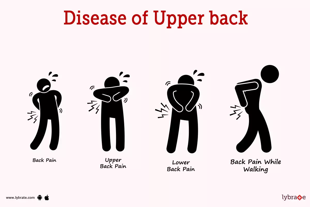 Upper Back (Human Anatomy): Picture, Functions, Diseases, and Treatments
