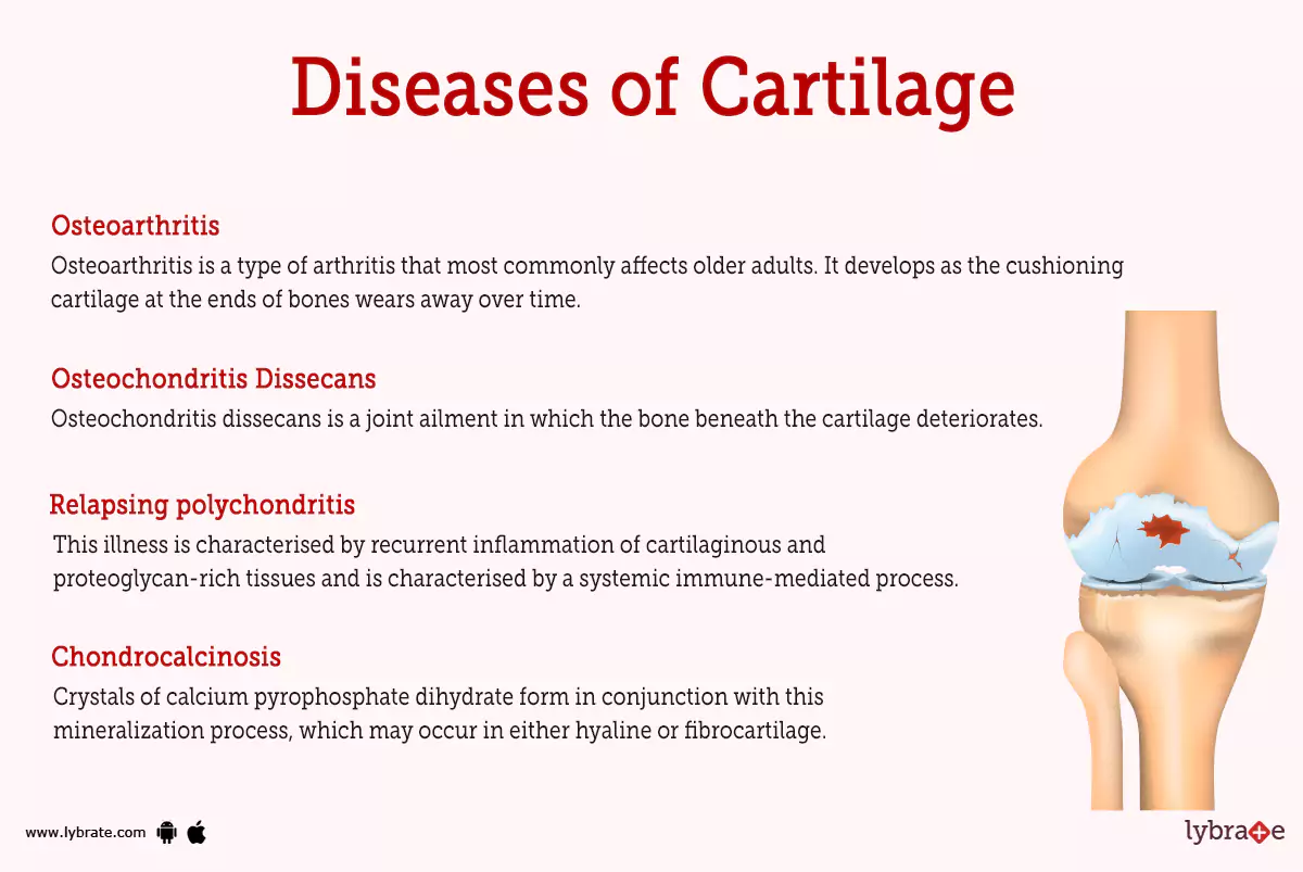 Cartilage Image (Human Anatomy): Picture, Functions, Diseases, and ...