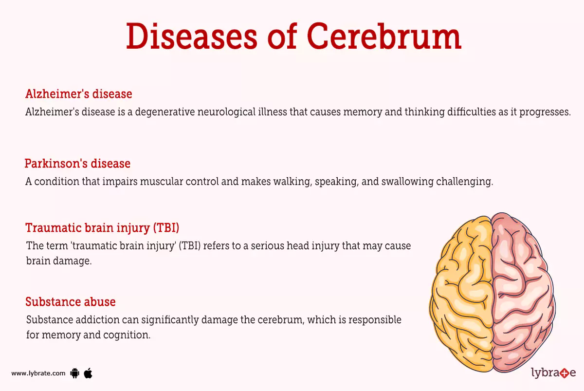 Cerebrum (Human Anatomy): Image, Functions, Diseases and Treatments