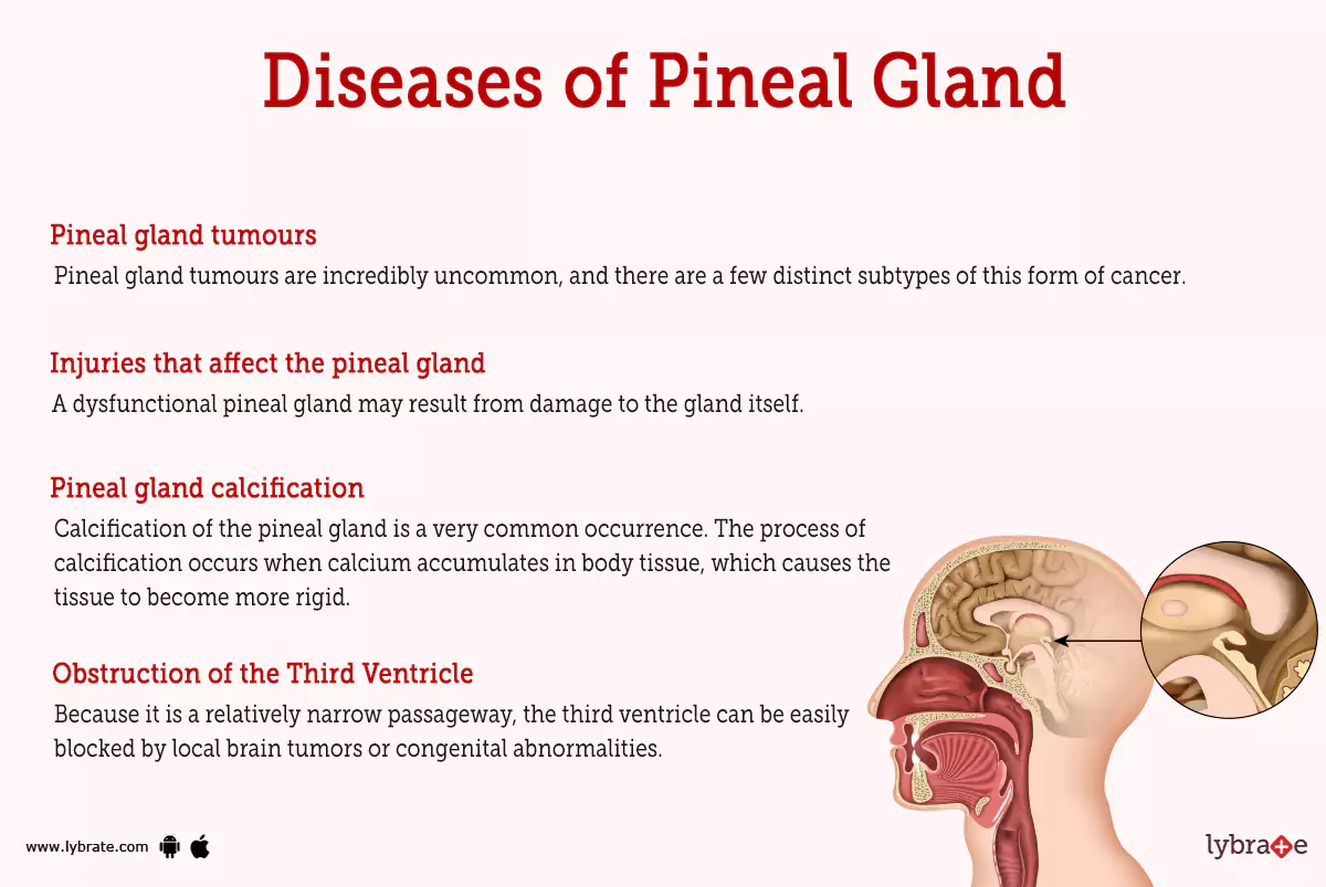 Pineal Gland (Human Anatomy): Picture, Functions, Diseases, and Treatments