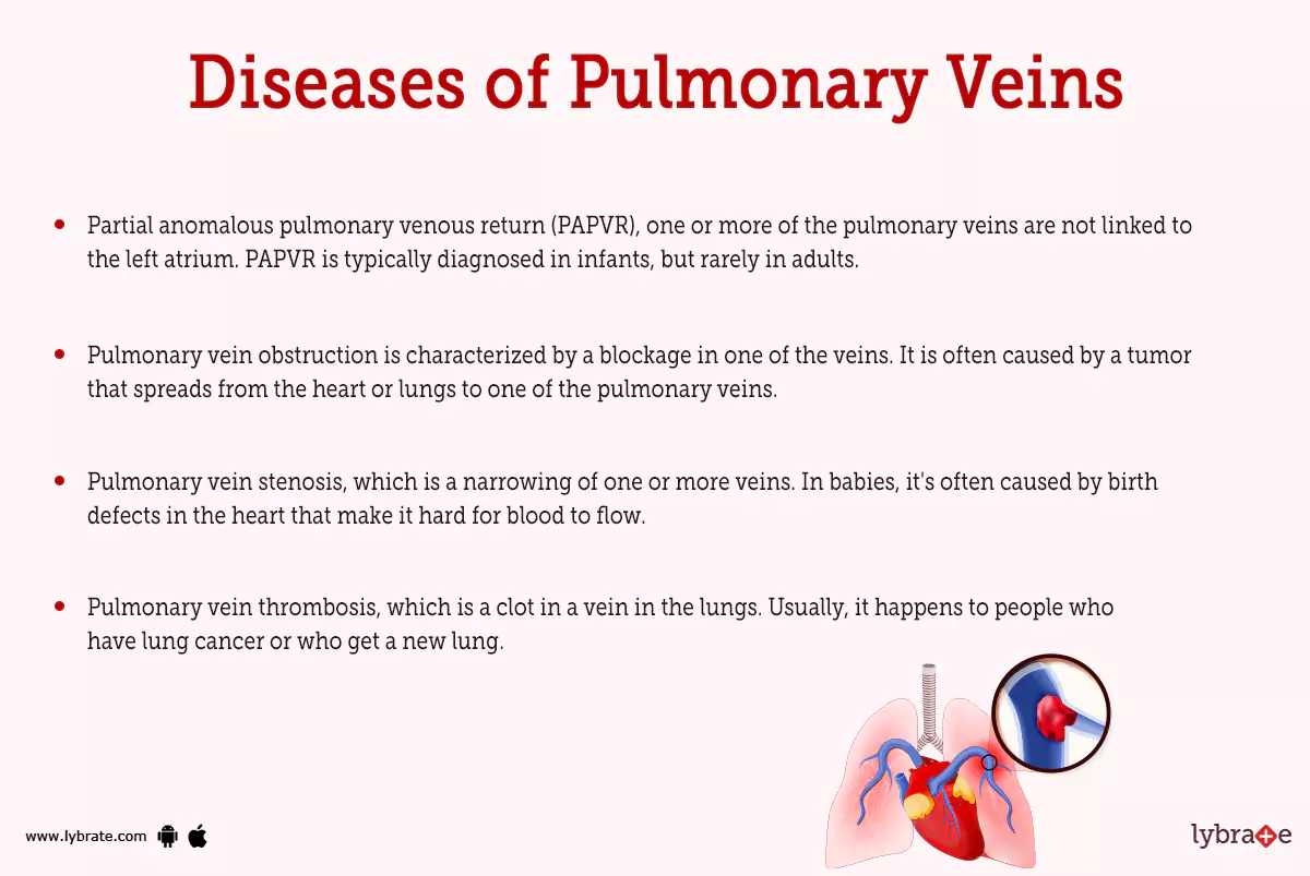 Pulmonary veins (Human Anatomy): Image, Functions, Diseases and Treatments
