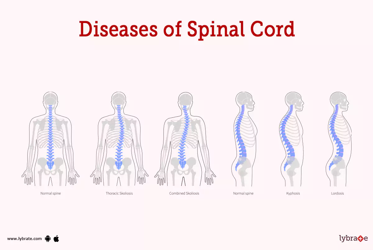 Spinal Cord (Human Anatomy): Picture, Functions, Diseases, and Treatments