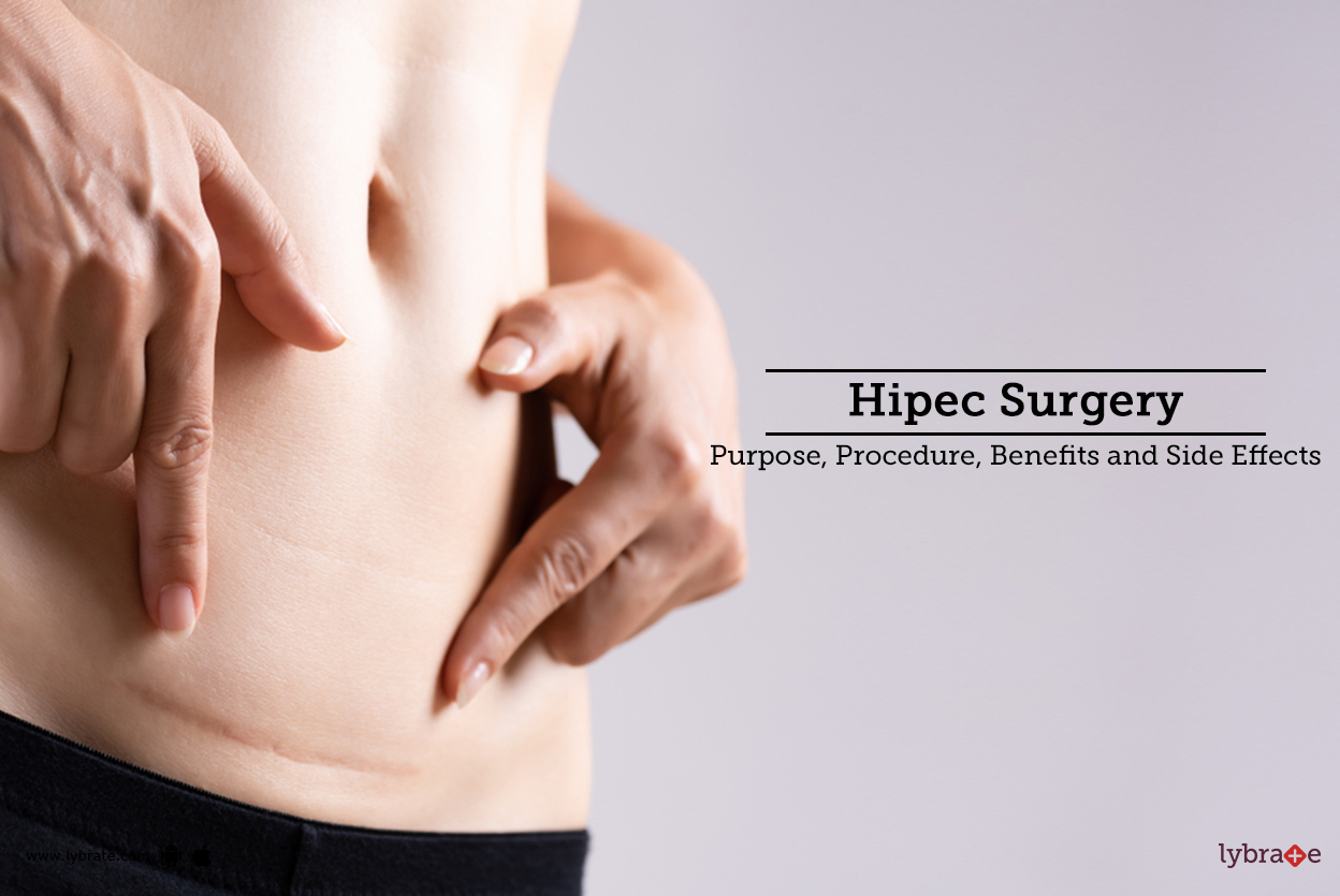 Hipec Surgery: Purpose, Procedure, and Benefits and Side Effects